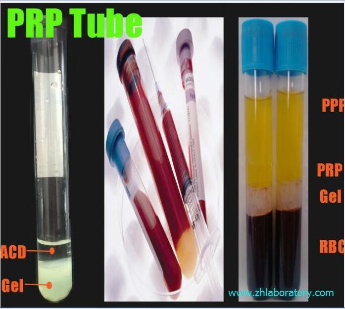 PRP/PRF CENTRIFUGE Equipment Kit PRP platelet rich plasma Medical Laboratory Centrifuge